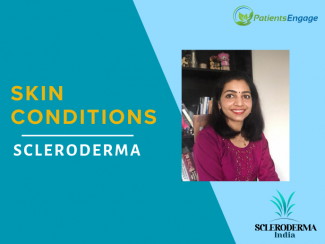 Managing Skin Conditions In Scleroderma | PatientsEngage